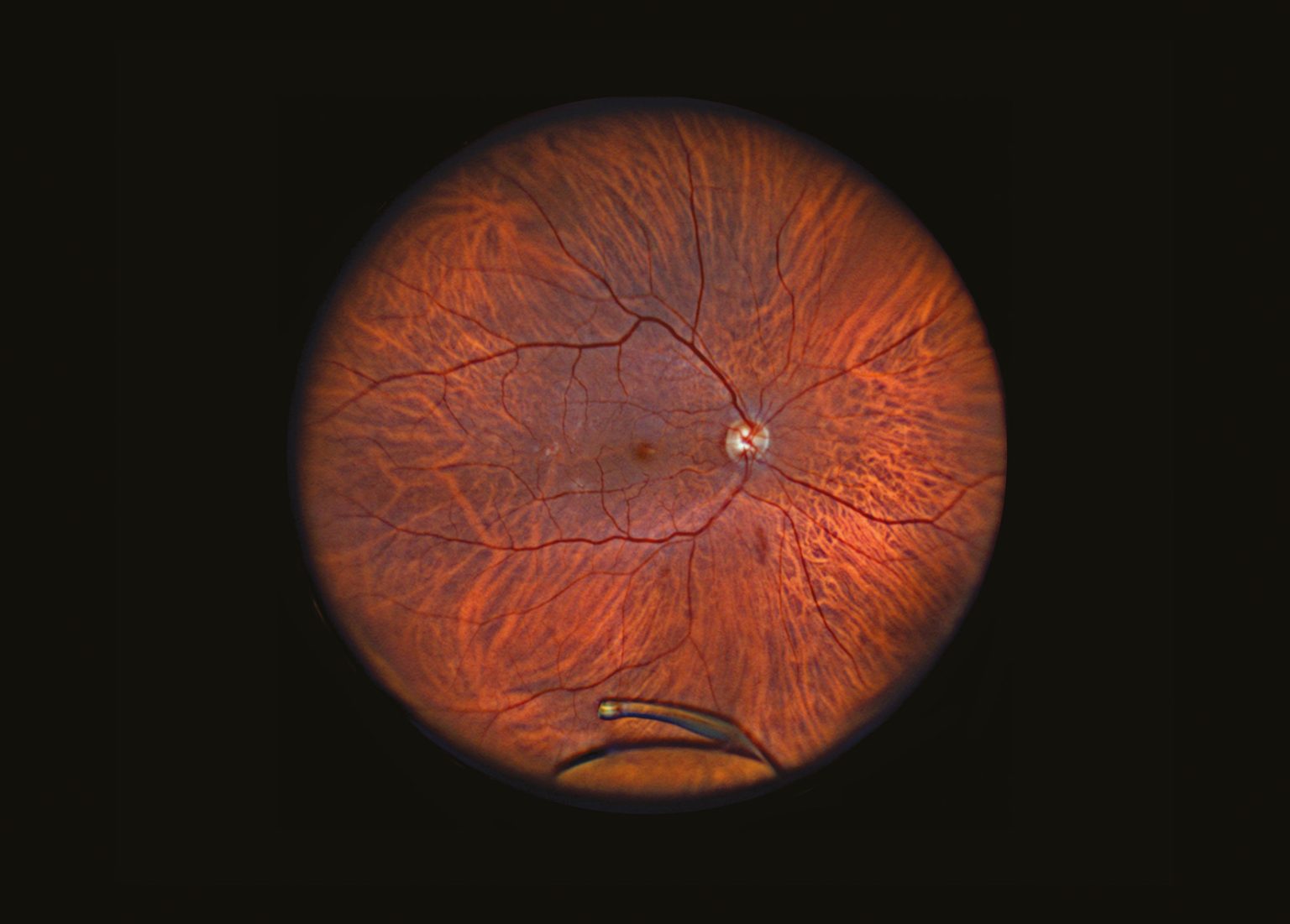 Cellview - Essilor Instruments